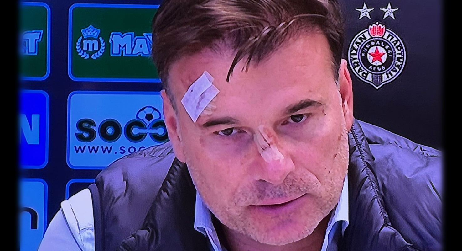 Partizan izgubio u derbiju, navijači razbili glavu treneru