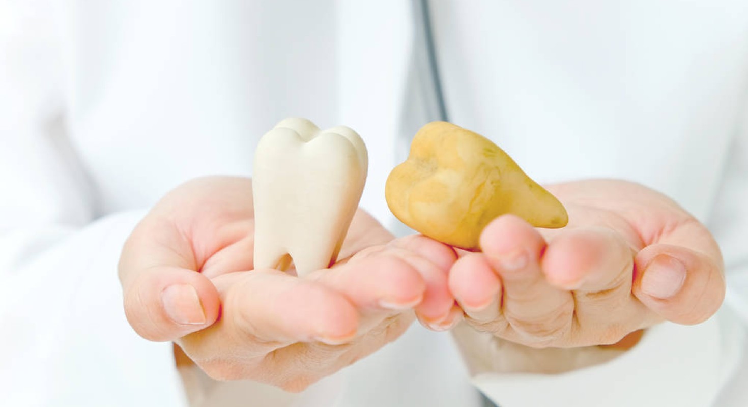 Upala kutnjaka – kako prepoznati problem i što učiniti na vrijeme